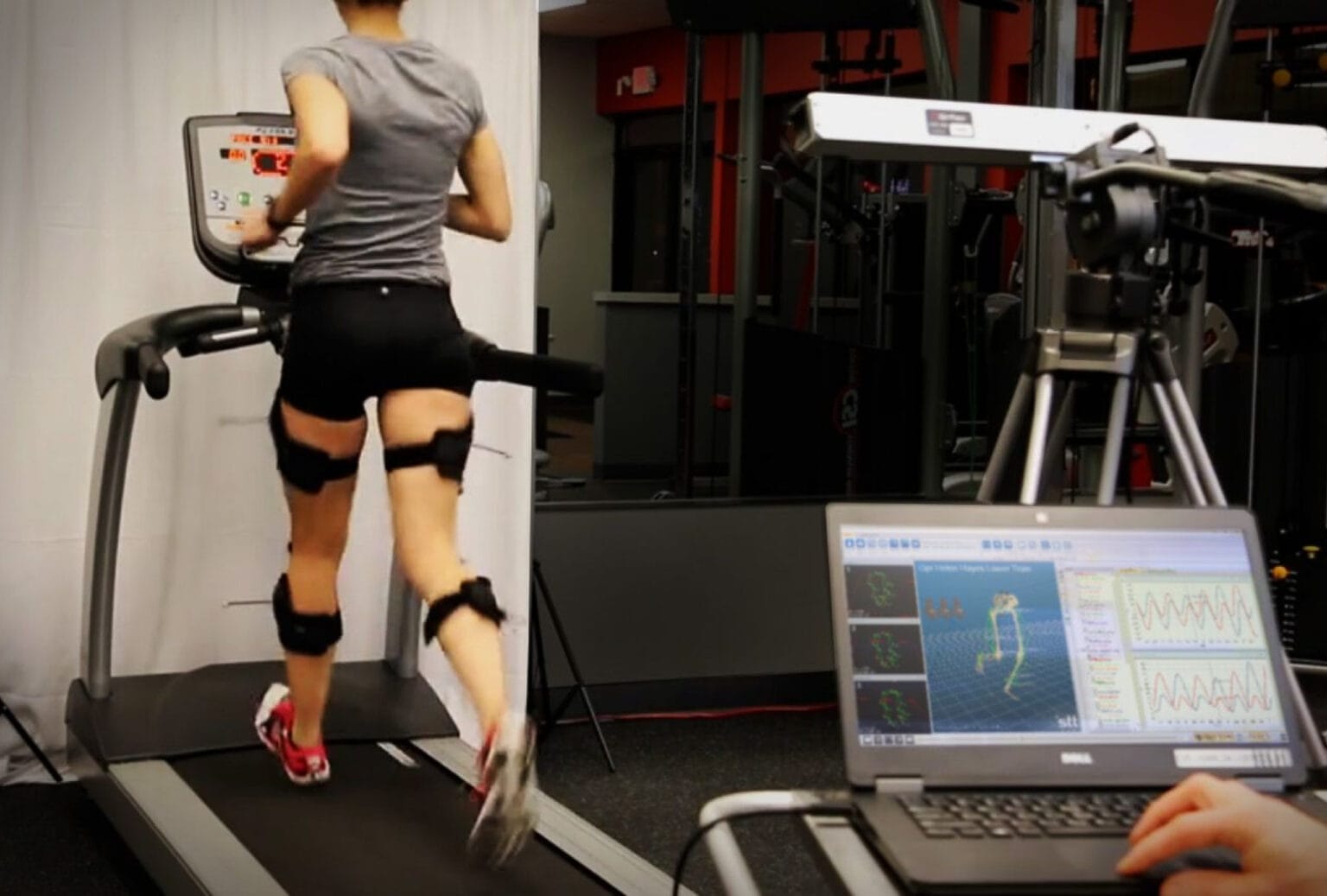 Why Understanding the Gait Cycle is Crucial for Your Health