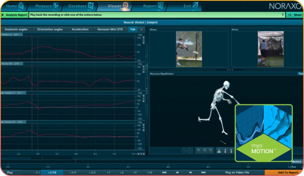 Best Gait Analysis Tools for Improved Mobility - RunDNA
